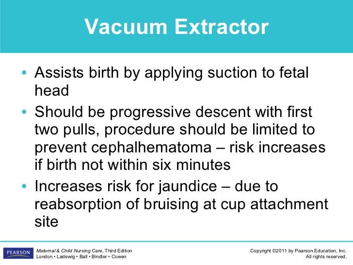 Birth related procedures 10 Birth related procedures 10