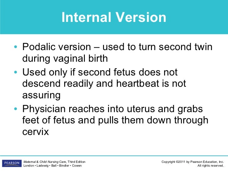 Birth related procedures 10 Birth related procedures 10