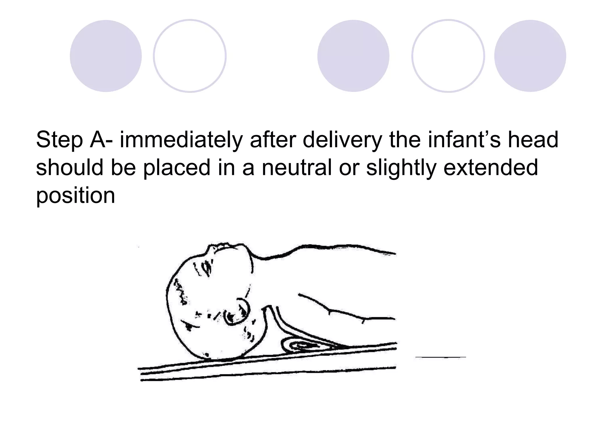 Birth Trauma. Asphyxia.ppt