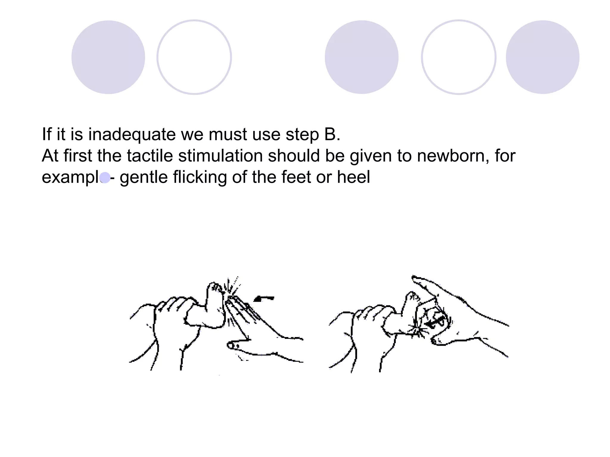 Birth Trauma. Asphyxia.ppt
