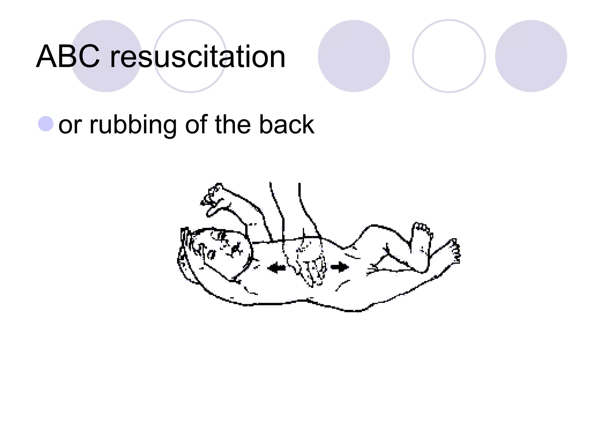Birth Trauma. Asphyxia.ppt