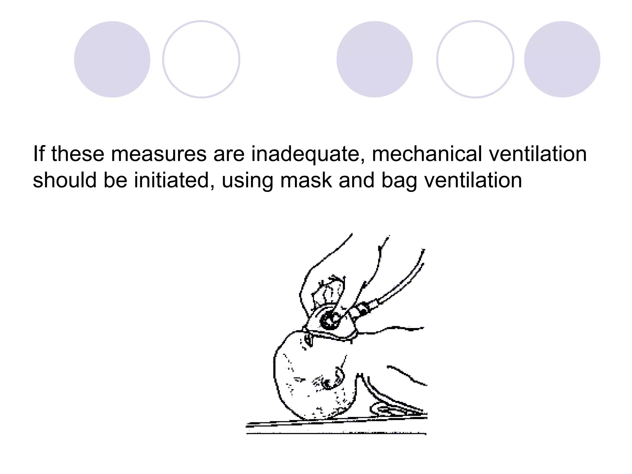 Birth Trauma. Asphyxia.ppt