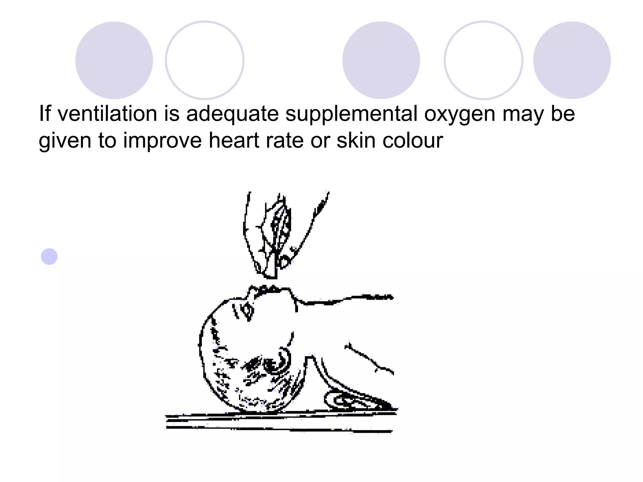 Birth Trauma. Asphyxia.ppt