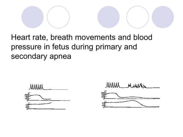 Birth Trauma. Asphyxia.ppt