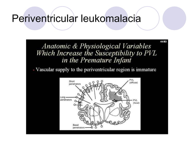 Birth Trauma. Asphyxia.ppt
