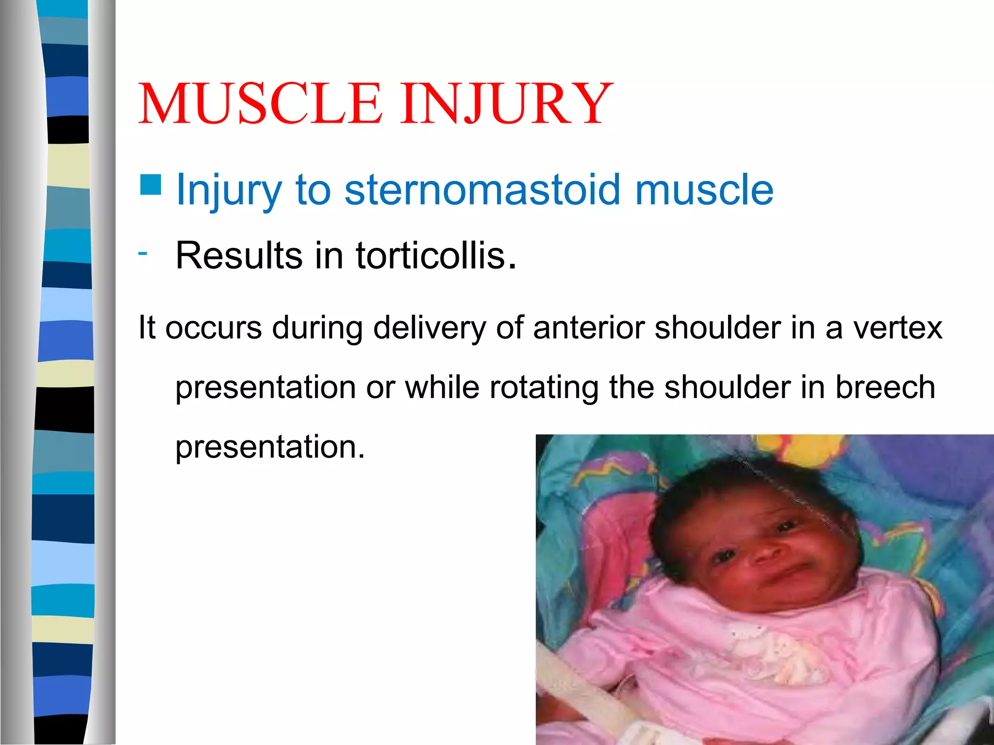 Birth trauma 2010 | PPT