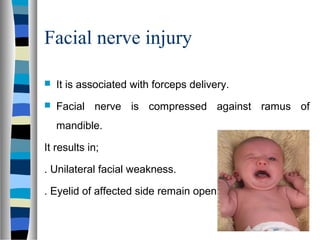 Birth trauma 2010 | PPT