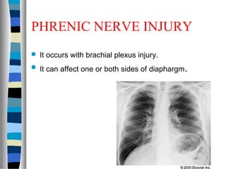 Birth trauma 2010 | PPT