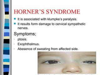 Birth trauma 2010 | PPT