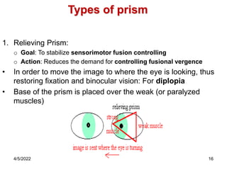 Refraction and optical management of strabismus patients | PPT