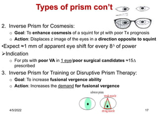 Refraction and optical management of strabismus patients | PPT