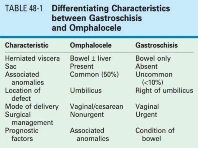 omphalocele and gastroschisis | PPTX