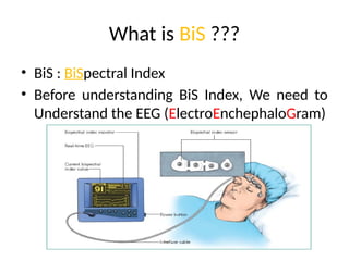 BiS (BiSpectral Monitoring ) IN CARDIAC SURGERY | PPTX