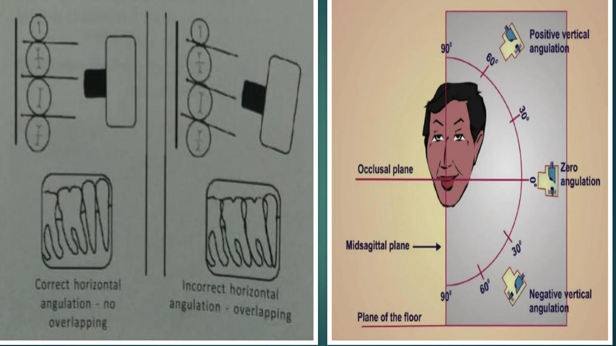 Bisecting Angle Technique Radiology PPT | PPTX