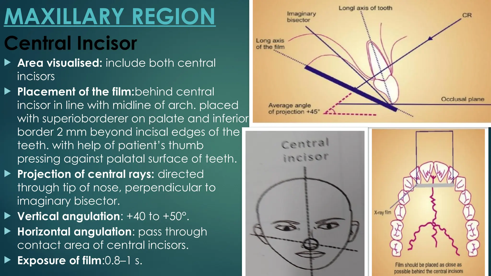 Bisecting Angle Technique Radiology PPT | PPTX