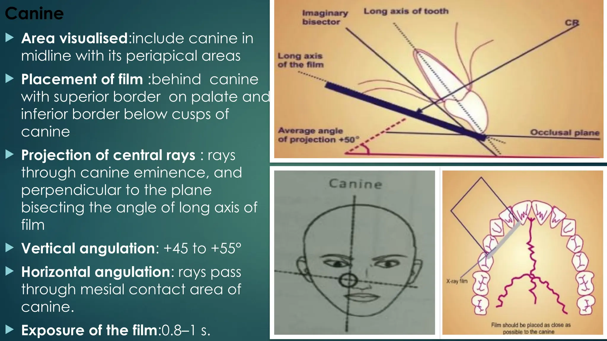 Bisecting Angle Technique Radiology PPT | PPTX