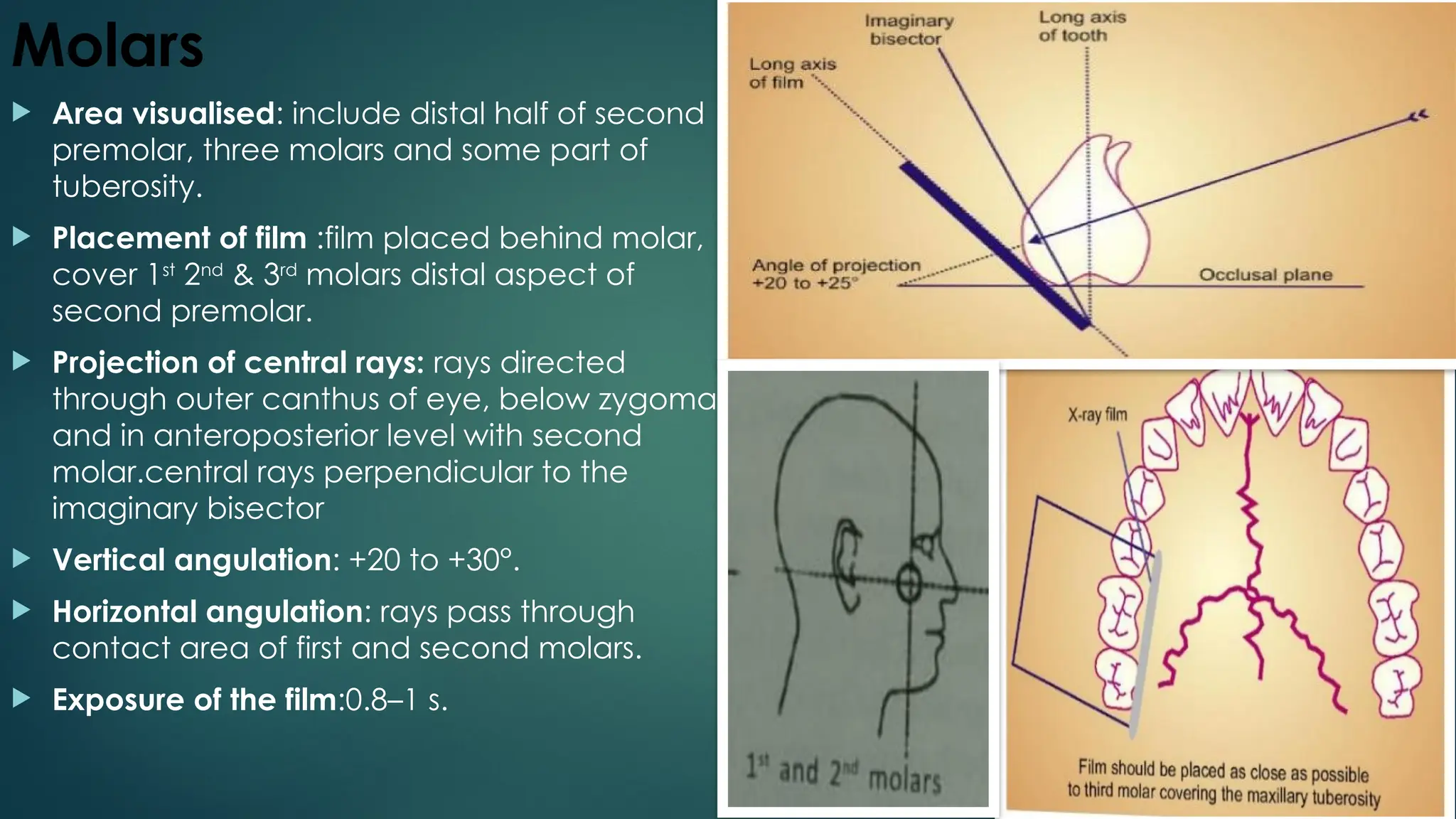 Bisecting Angle Technique Radiology PPT | PPTX