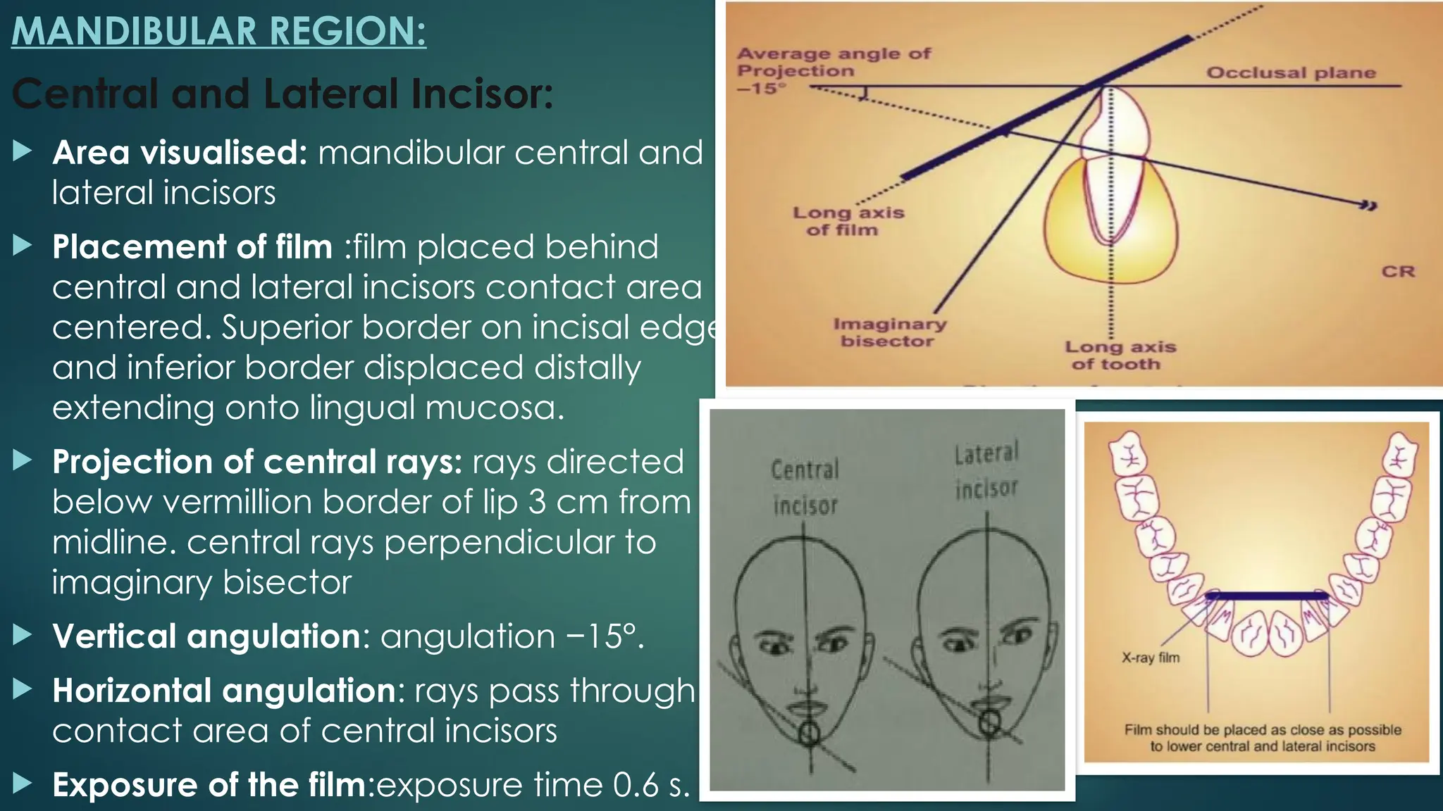 Bisecting Angle Technique Radiology Ppt Pptx