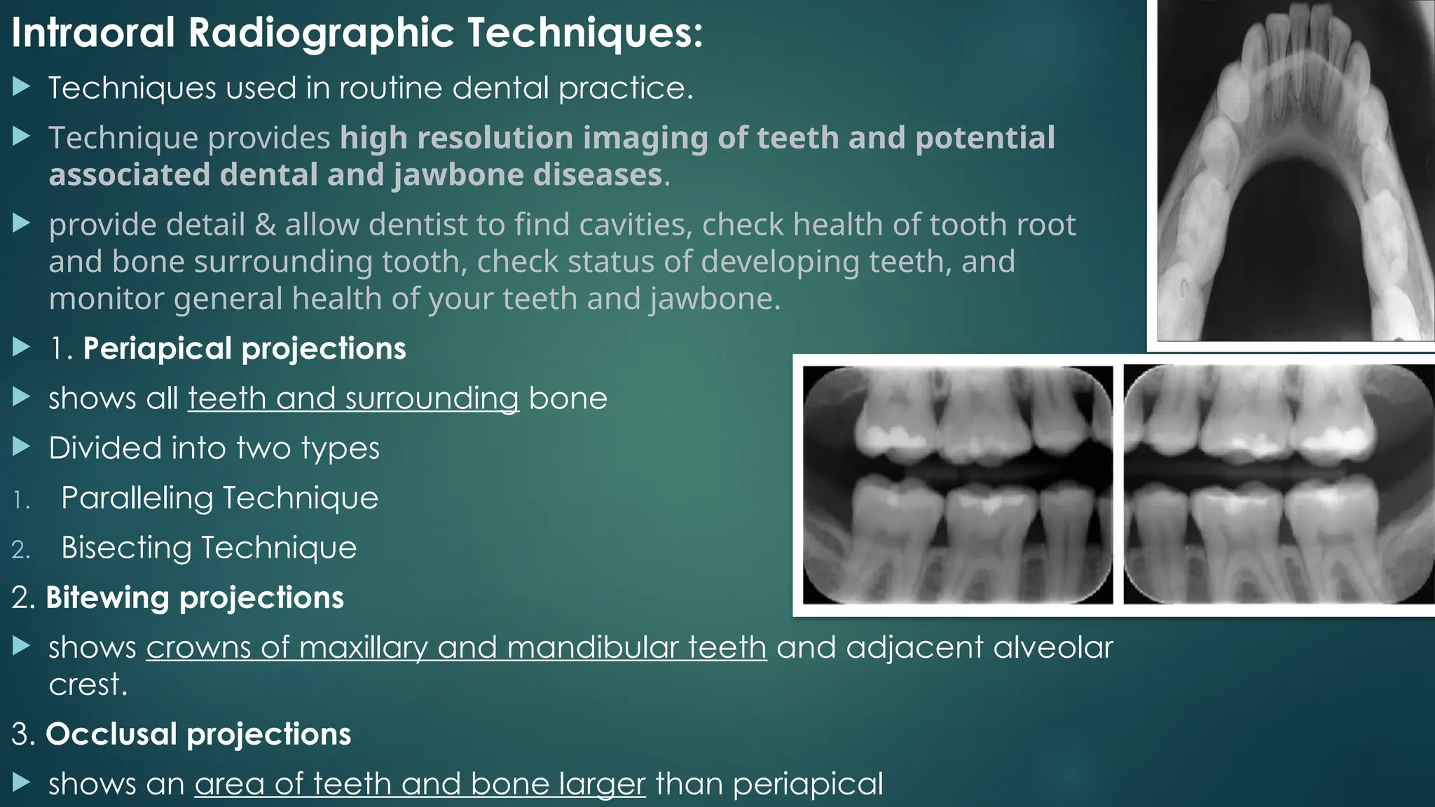 Bisecting Angle Technique Radiology PPT | PPTX