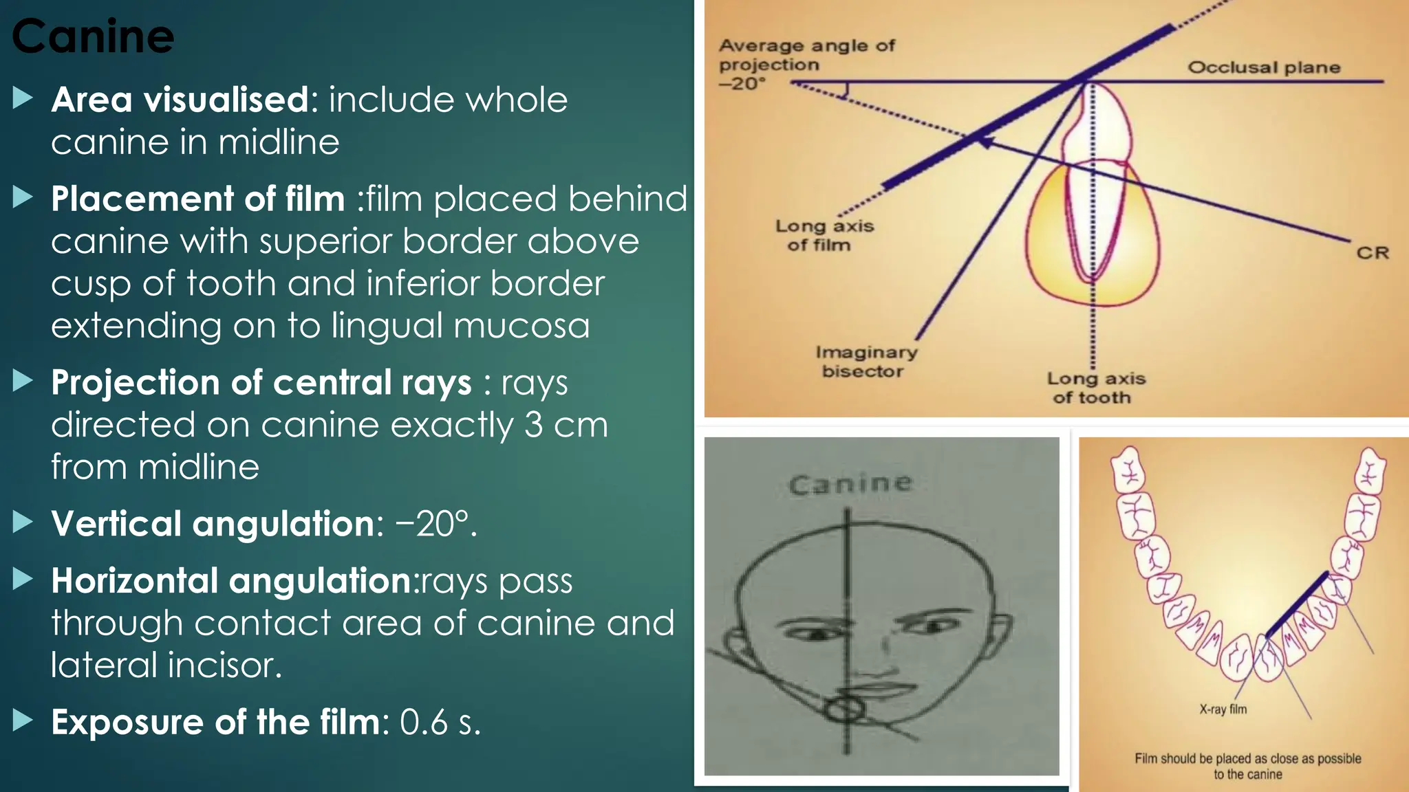Bisecting Angle Technique Radiology PPT | PPTX
