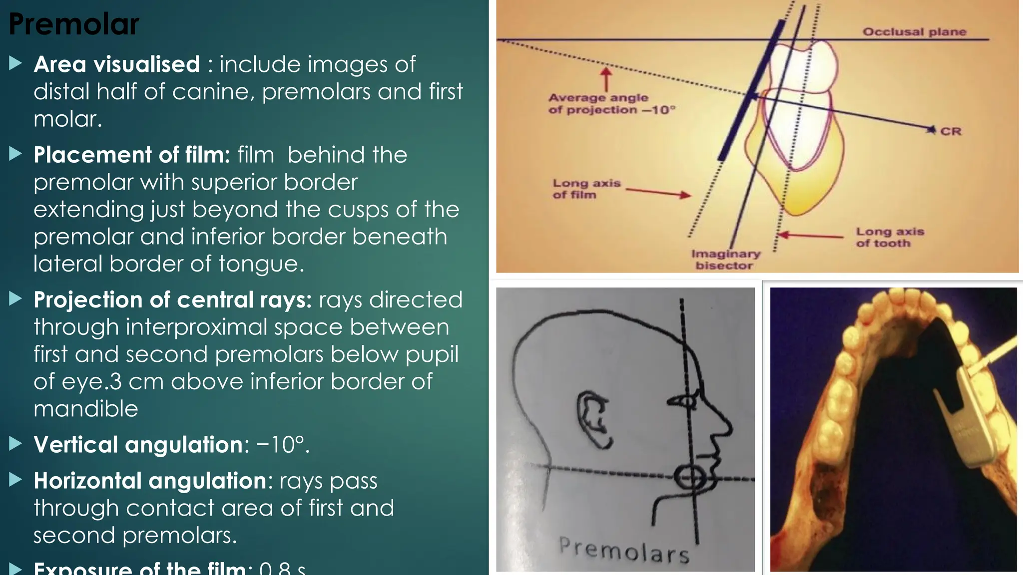 Bisecting Angle Technique Radiology PPT | PPTX
