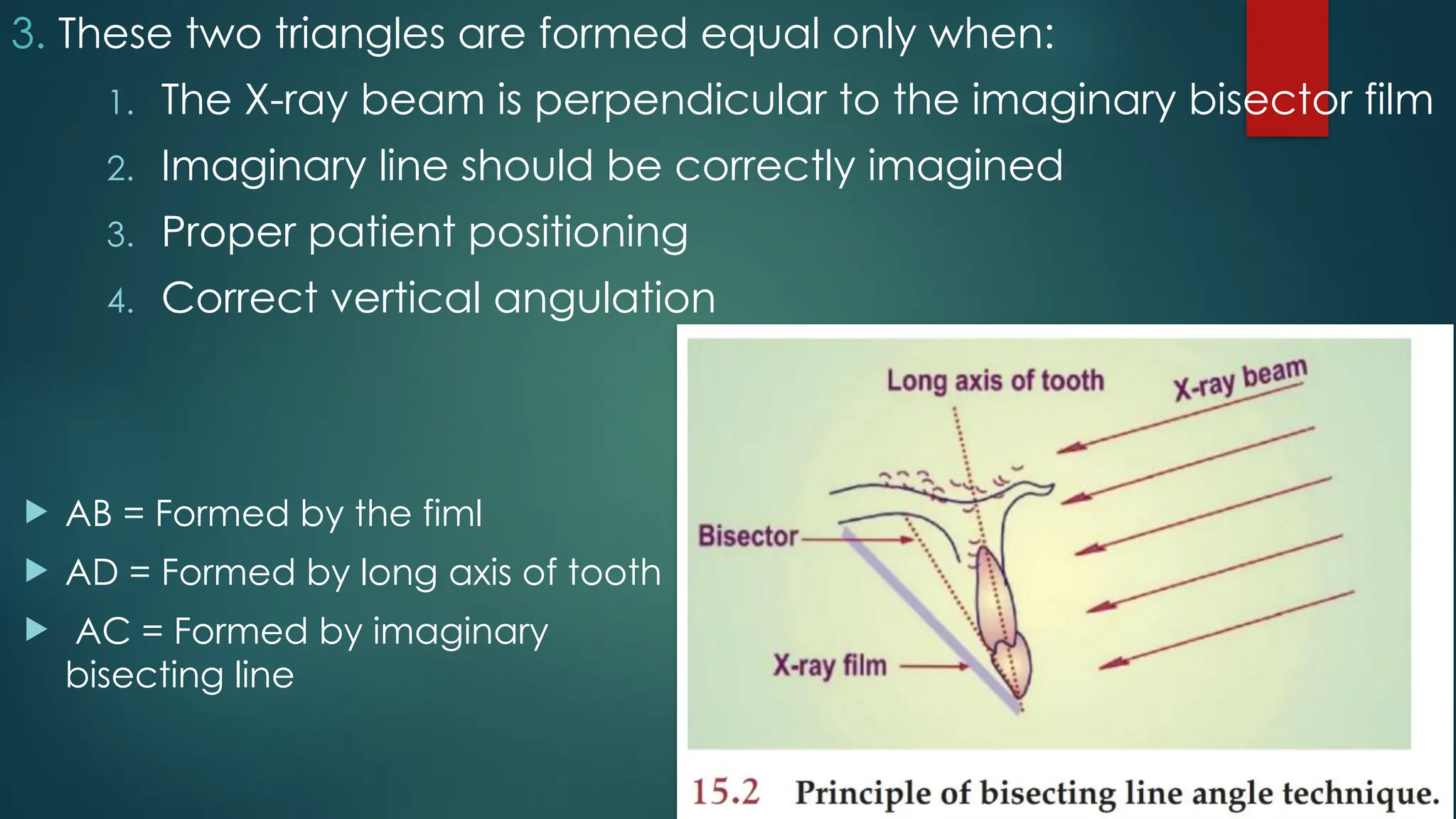 Bisecting Angle Technique Radiology Ppt Pptx