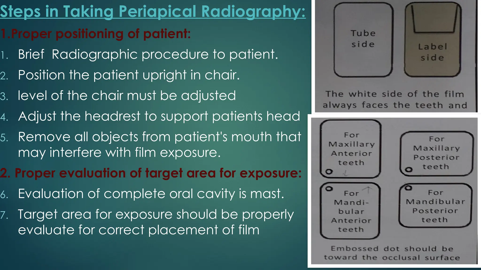 Bisecting Angle Technique Radiology PPT | PPTX