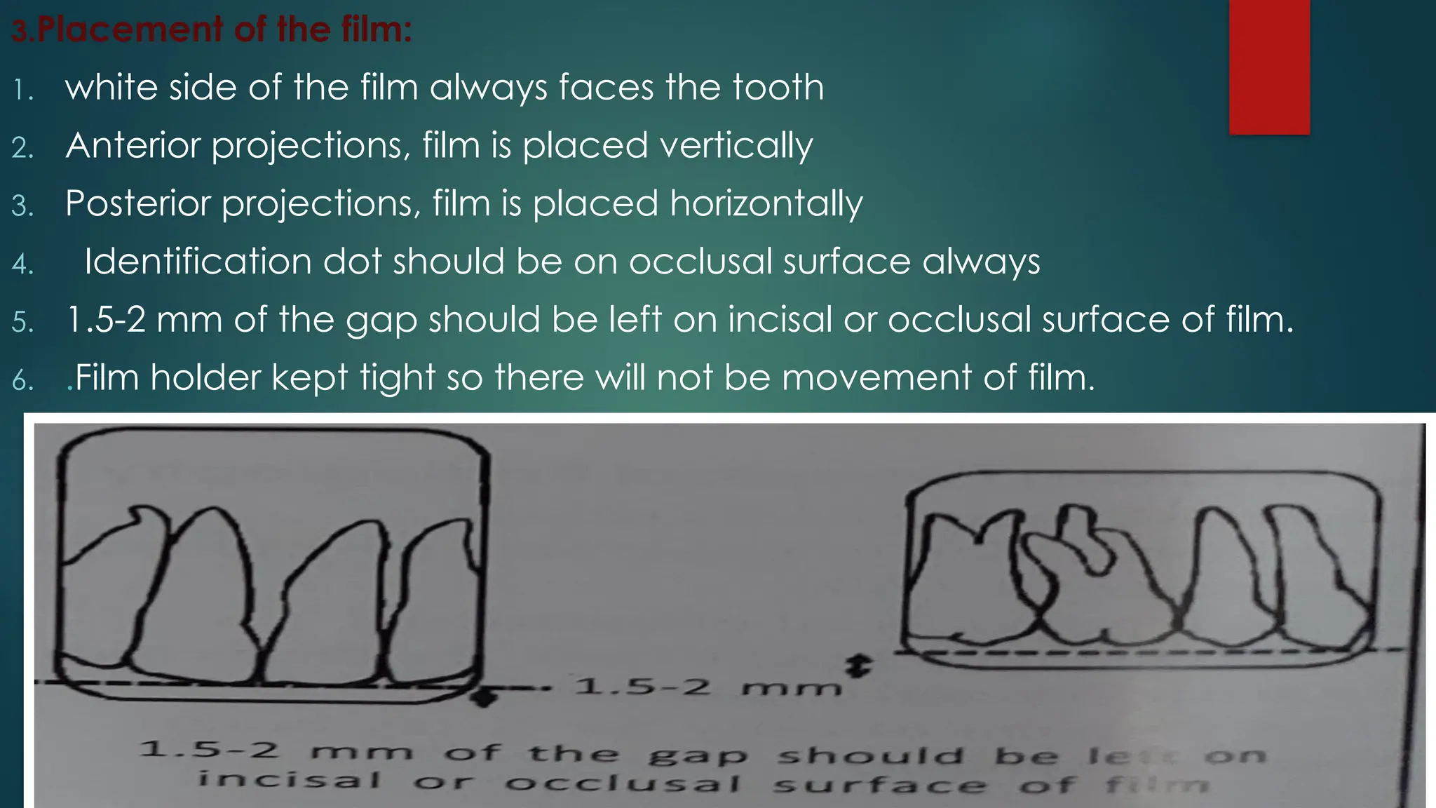 Bisecting Angle Technique Radiology PPT | PPTX