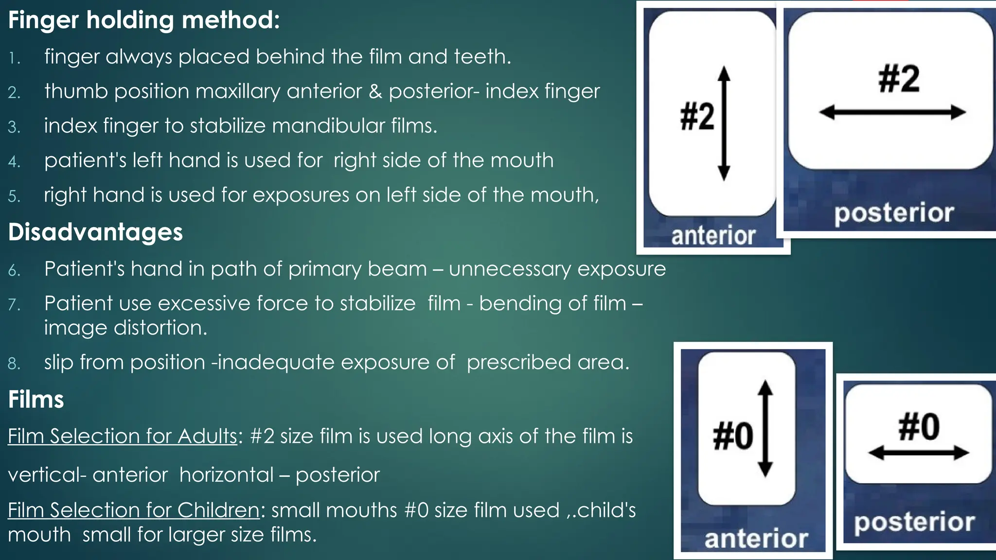 Bisecting Angle Technique Radiology PPT | PPTX