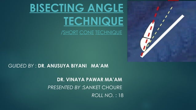 Bisecting Angle Technique Radiology PPT | PPTX