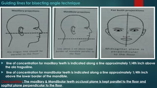 Bisecting Angle Technique Radiology PPT | PPTX