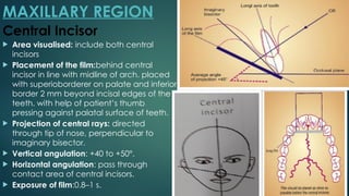 Bisecting Angle Technique Radiology PPT | PPTX