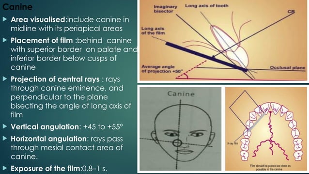 Bisecting Angle Technique Radiology PPT | PPTX
