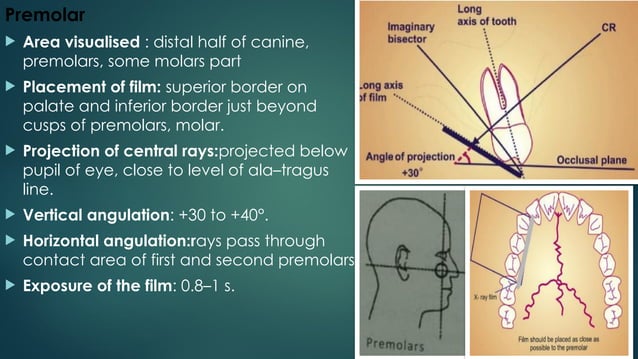 Bisecting Angle Technique Radiology PPT | PPTX