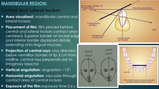 Bisecting Angle Technique Radiology PPT | PPTX