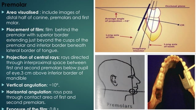 Bisecting Angle Technique Radiology PPT | PPTX