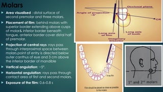 Bisecting Angle Technique Radiology PPT | PPTX
