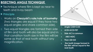 Bisecting Angle Technique Radiology PPT | PPTX