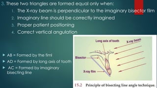 Bisecting Angle Technique Radiology PPT | PPTX