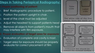 Bisecting Angle Technique Radiology PPT | PPTX