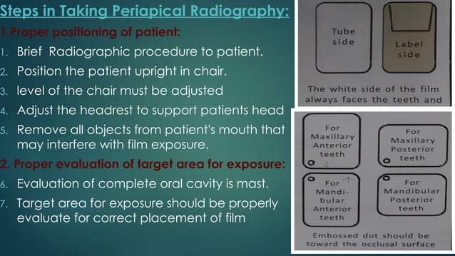 Bisecting Angle Technique Radiology PPT | PPTX