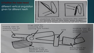 Bisecting Angle Technique Radiology PPT | PPTX