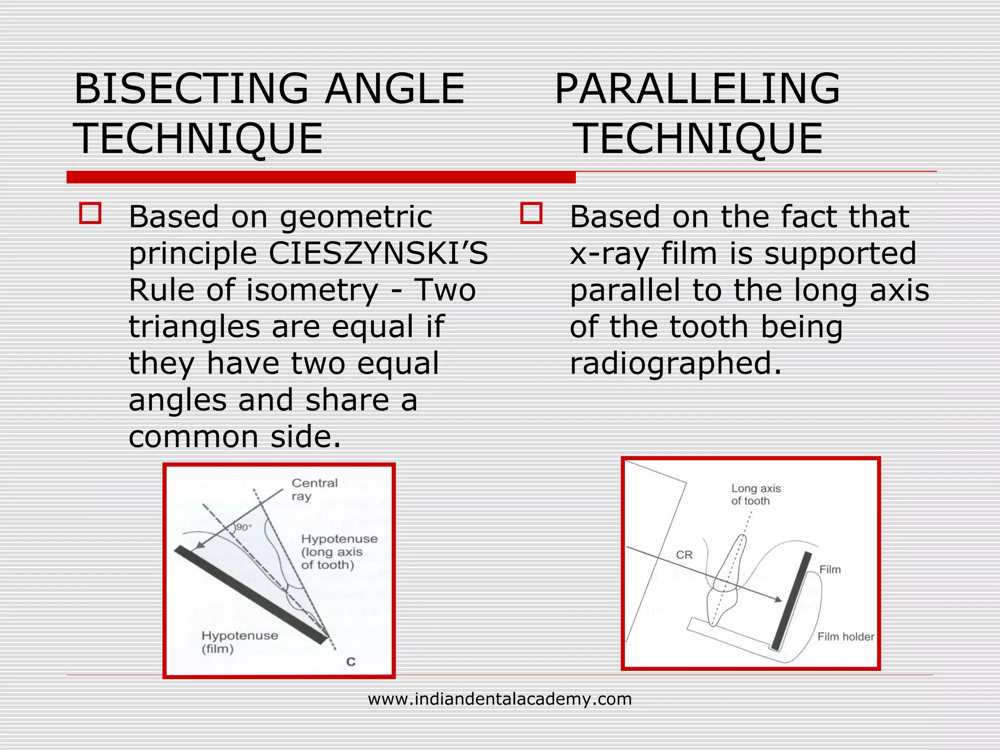 Bisecting angle vs paralleling technique /orthodontic courses by Indian ...