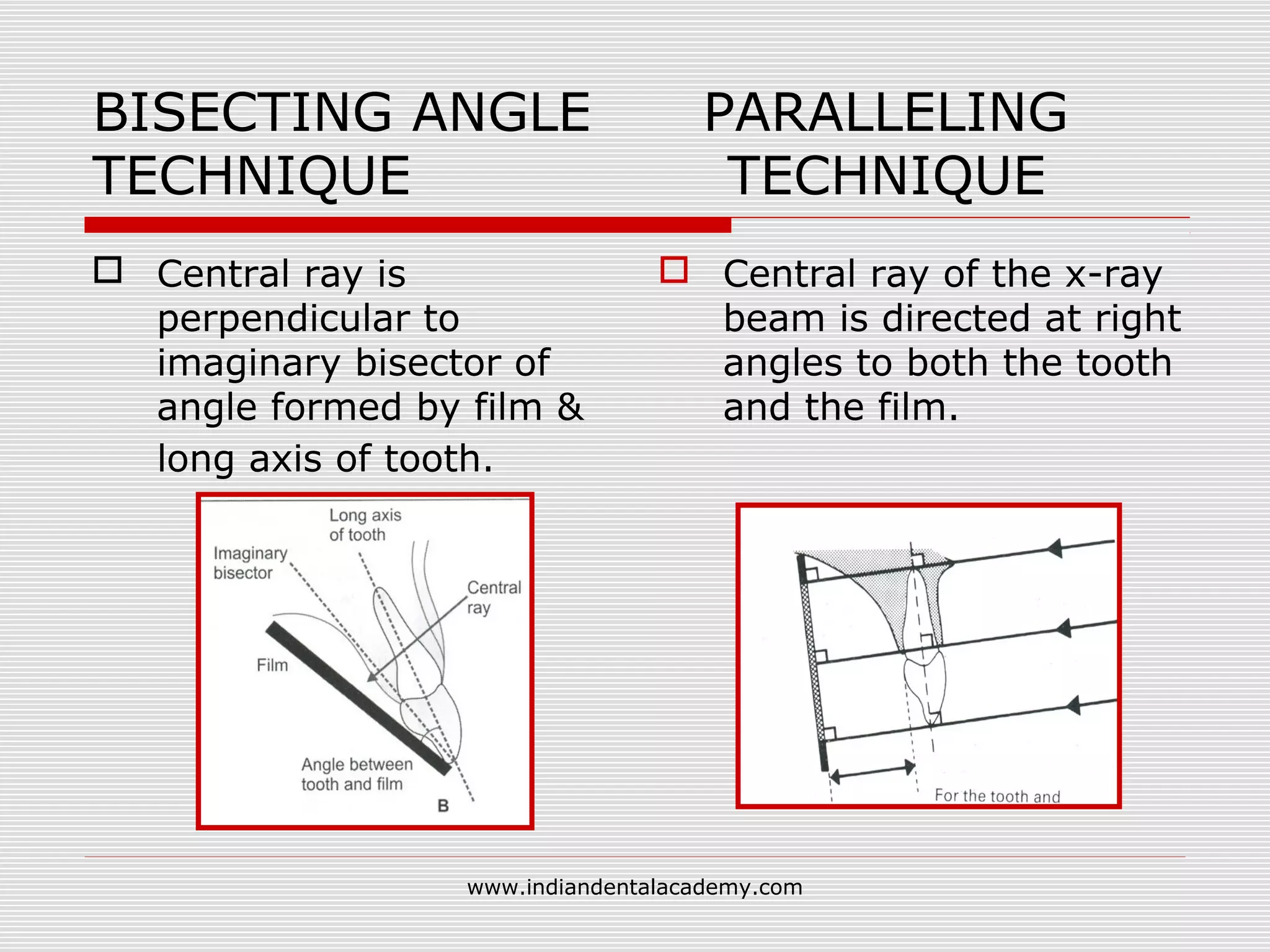 Bisecting angle vs paralleling technique /orthodontic courses by Indian ...