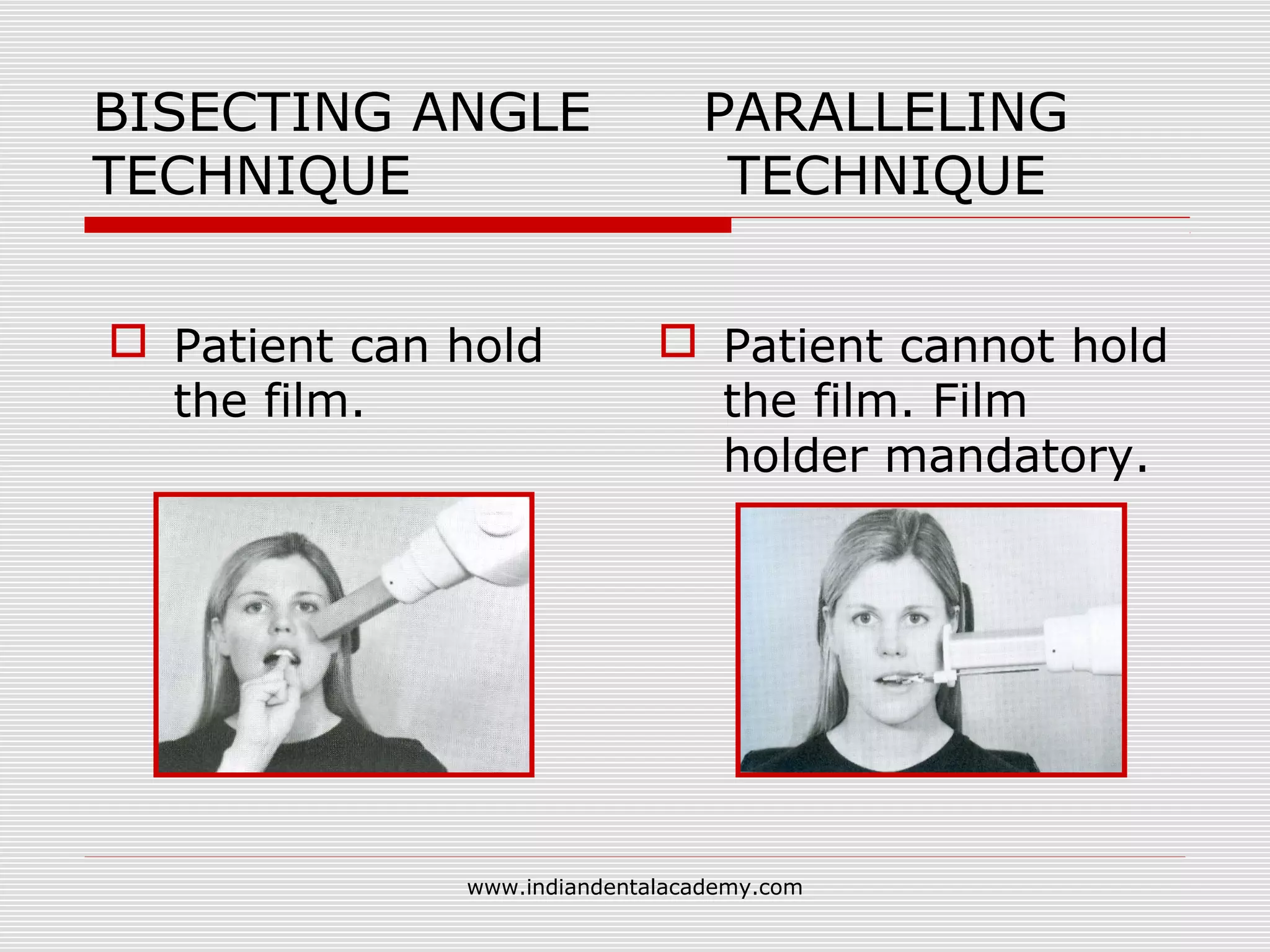 Bisecting angle vs paralleling technique /orthodontic courses by Indian ...