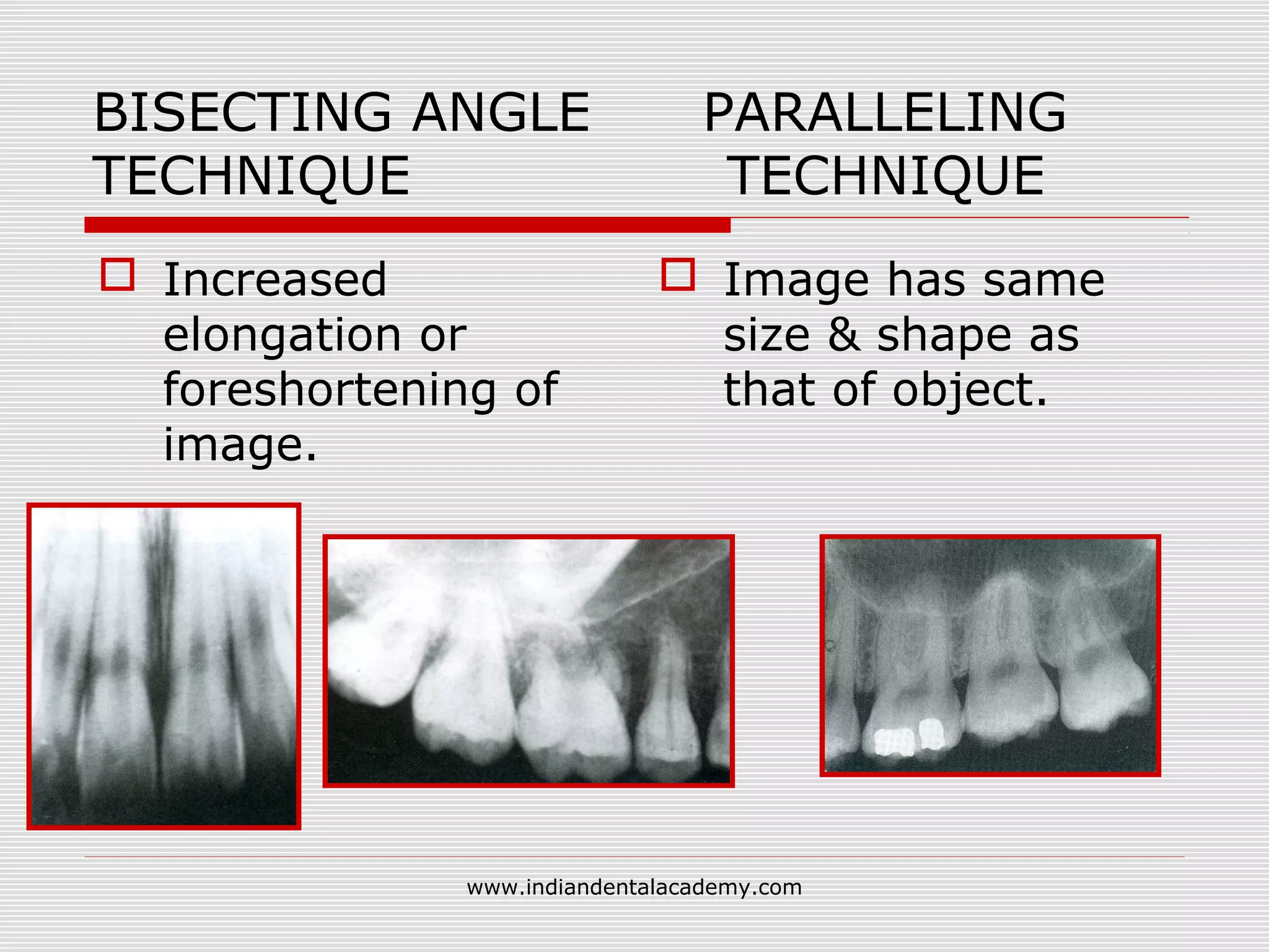Bisecting angle vs paralleling technique /orthodontic courses by Indian ...