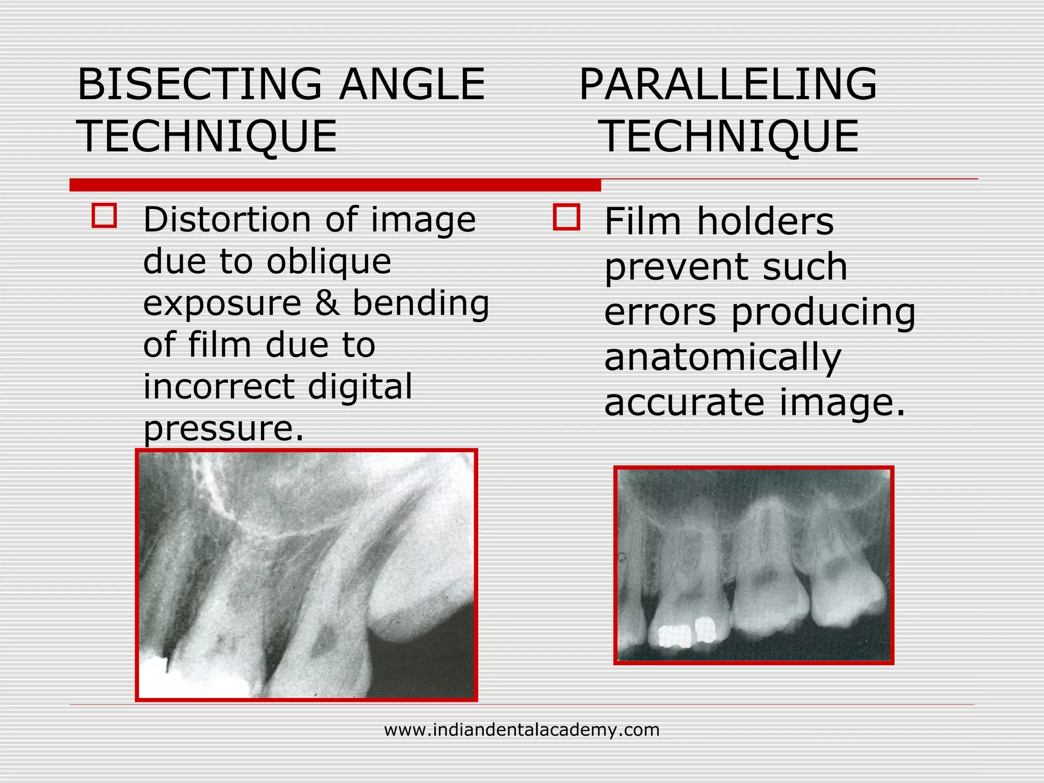Bisecting angle vs paralleling technique /orthodontic courses by Indian ...