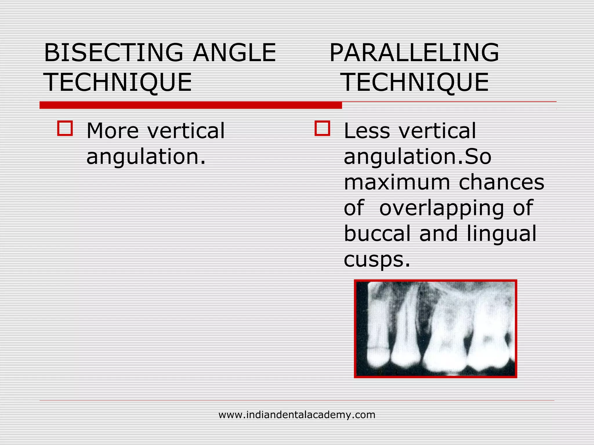 Bisecting angle vs paralleling technique /orthodontic courses by Indian ...