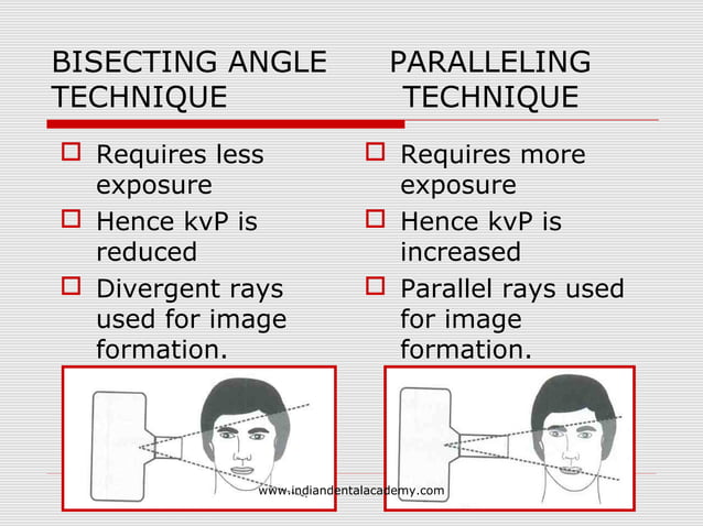 Bisecting angle vs paralleling technique /orthodontic courses by Indian ...