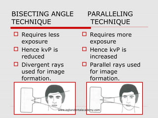 Bisecting angle vs paralleling technique /orthodontic courses by Indian ...